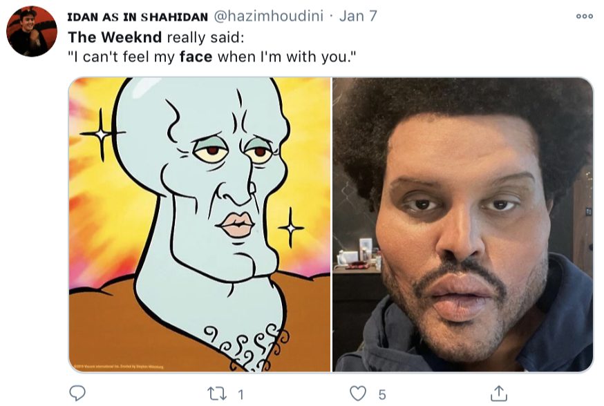 The Weeknd’s Plastic Surgery – all you need to know