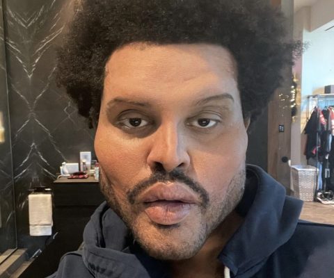 The Weeknd’s Plastic Surgery – all you need to know