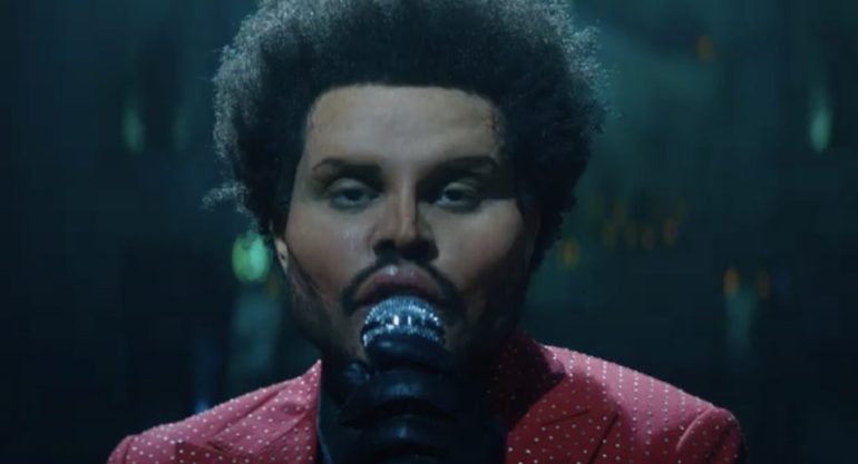 The Weeknd’s Plastic Surgery Archives - KAYA 959