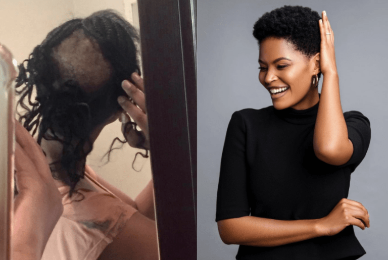 Gail Mabalane opens up about her journey with hair loss (Alopecia)