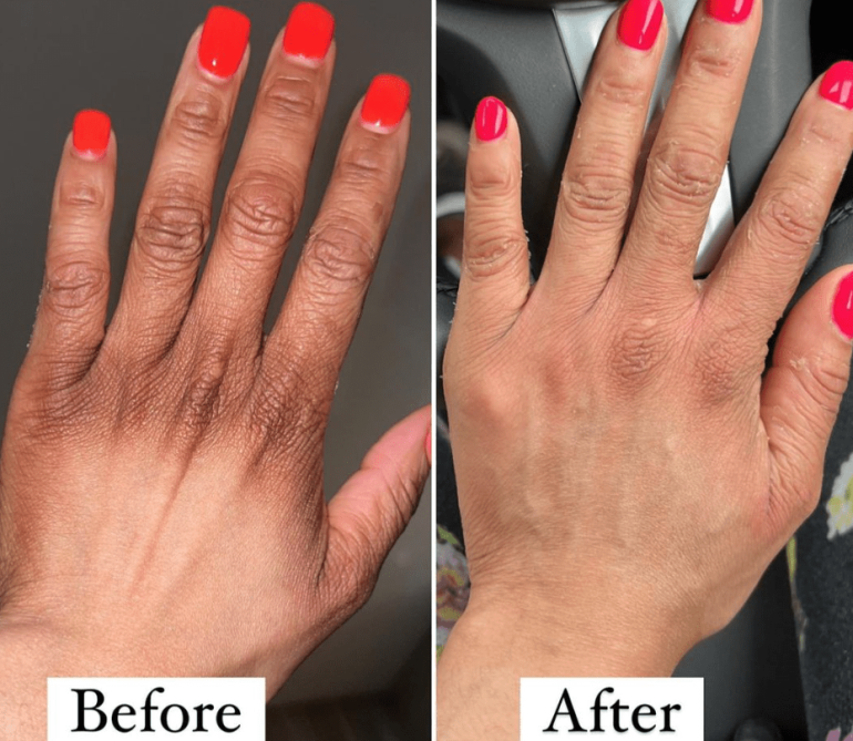 Khanyi Mbau "bleaches" her dark hands - KAYA 959